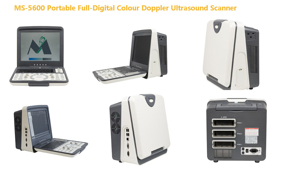 (MS-5600) Portable Full-Digital Colour Doppler Ultrasound Scanner - Buy ...