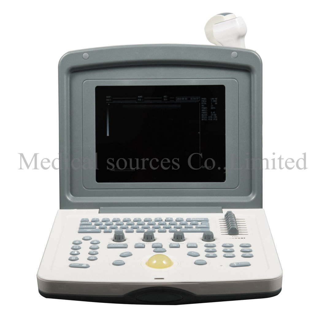 (MS-P800) Best Quality Full Digital Laptop Ultrasound Scanner - Buy ...